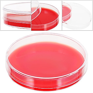Baluue 10pcs Plastic Petri Dishes, Nutrient Agar Plate Sciences Nutrient Agar Petri Dishes Biological Dish Science Project Kit Supplies for Mushroom Petri Projects Red