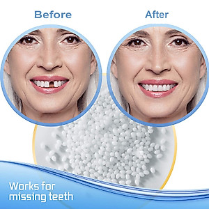 Tooth Repair Kit, Moldable False Teeth Thermal Fitting Beads,Temporary Filling Broken Teeth Gap for Snap On Instant and Confident Smile, Denture Adhesive
