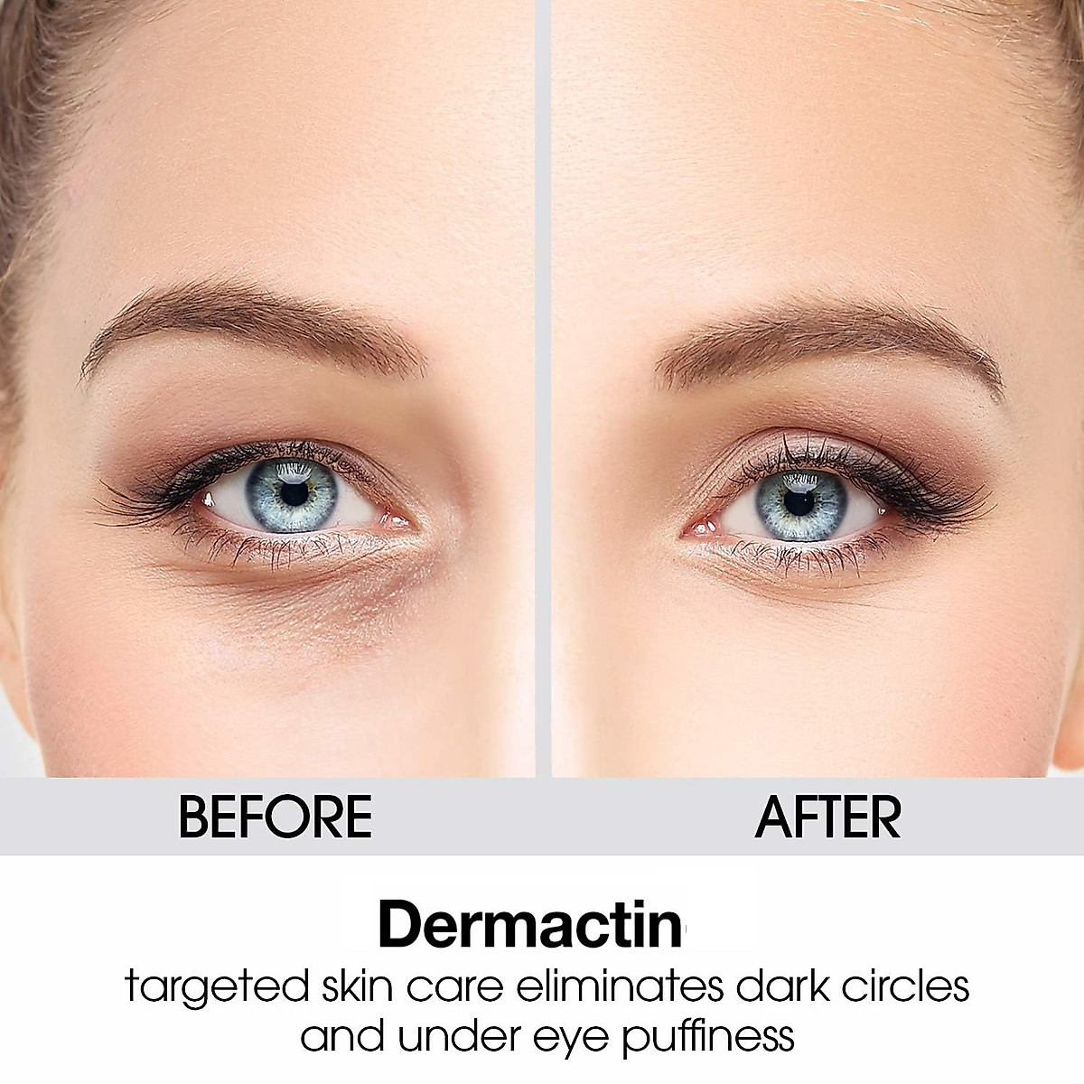 Dermactin Upper Eyelid Cream 1 oz. Firms & Tones Sagging & Drooping Skin On Upper Eye Lids, for Younger, More Vibrant & Alert Appearance, for Sensitive Skin In The Eyelids