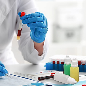 AKOLAFE 100PCS 30ml Plastic Empty Liquid Dropper Bottles with Caps 1oz Refillable Ldpe Plugs Essential Oil Bottle Container Empty Squeezable Liquid Dropper Bottle for Travelers