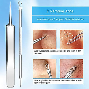 Best Blackhead Remover, Blackheads Blemish Removing, Acne Whitehead Removal Kit, Pimple Comedone Extractor Tool, Popper Pimples Treatment, with Tweezers, Risk Free for Face Forehead Nose