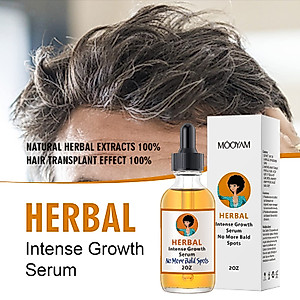 Ginger Hair Growth Serum - Treats Thinning, Hair Loss, Dry & Itchy Scalp, Dandruff - Hair Regrowth Treatment for Men and Women - 2OZ