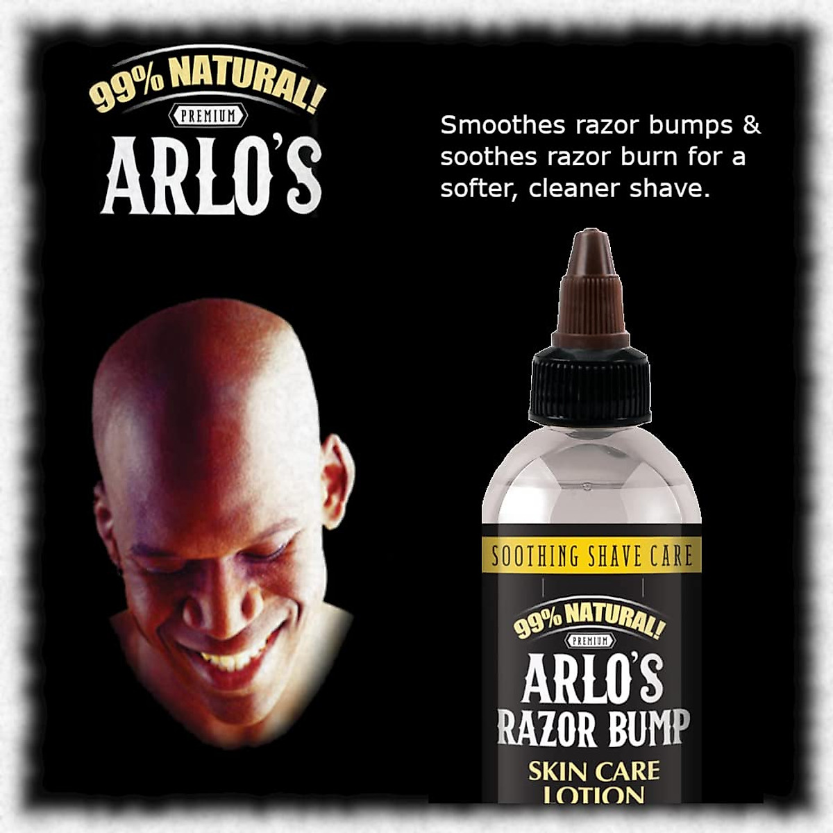 Arlo's Razor Bump Skin Care Lotion 6 oz.