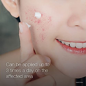 Neutrogena Rapid Clear Stubborn Acne Spot Treatment Gel with Maximum Strength 10% Benzoyl Peroxide Acne Treatment Medication, Pimple Cream for Acne Prone Skin Care, 1 oz