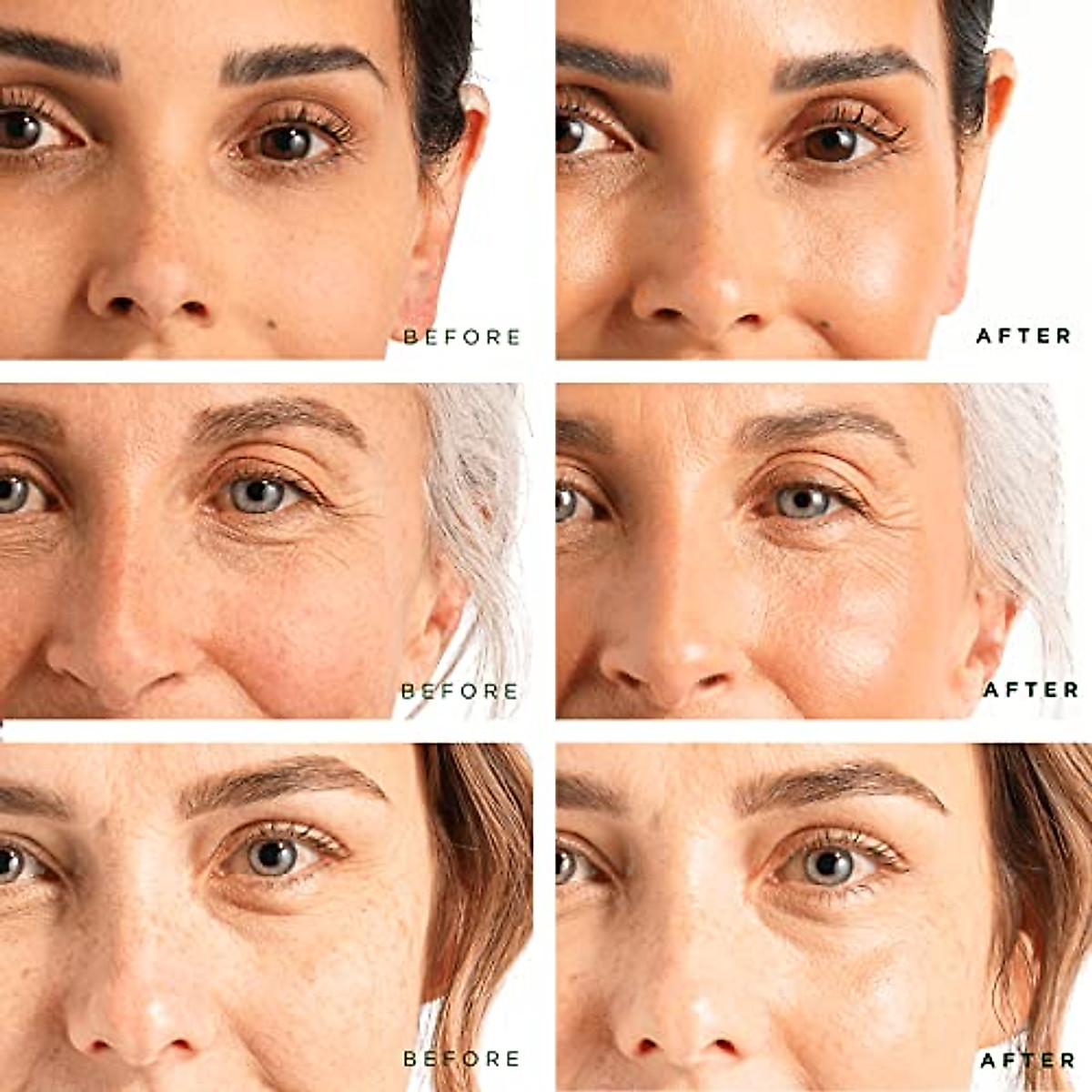 Tree of Life Vitamin C Serum, Retinol Serum and Hyaluronic Acid Serum for Brightening, Firming, and Hydrating for Face; Total Skin Reset Day & Night, 3 Count x 1 Fl Oz