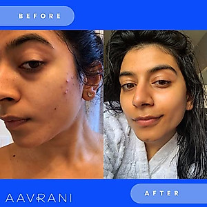 AAVRANI Glow Activating Exfoliator – Stain-Free Turmeric Face Mask with Raw Honey, JoJoba, and Neem – Exfoliating Clay Mask for Acne, Dark Spots, and Deep Pore Cleansing (1.0 Fl Oz)