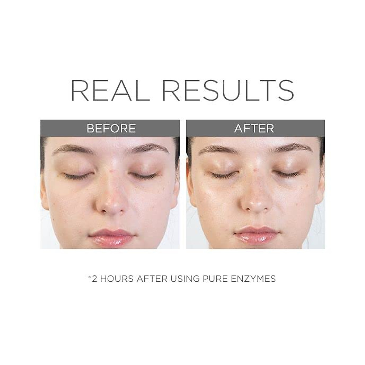 COSMEDIX Pure Enzymes Cranberry Exfoliating Mask, Gently Exfoliates Dry Skin, Helps Smooth Skin Texture, L-Lactic Acid & Cranberry Enzymes, Cruelty Free