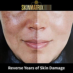 Dark Spot Corrector- Skin Brightening Cream Naturally Fades Spots and Marks for Face & Body. Repairs Uneven Skin Tone & Complexion. Removes Age Spots, Freckles, & Acne Scars.