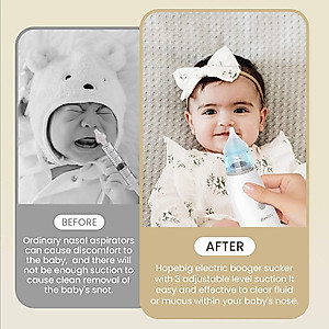 Hopebig Nasal Aspirator Baby Nose Sucker, Electric Baby Nose Sucker with Adjustable 3 Levels Suction & 2 Size Nozzles with Music & Light Soothing Function for Toddler