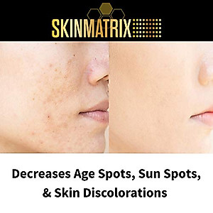 Dark Spot Corrector- Skin Brightening Cream Naturally Fades Spots and Marks for Face & Body. Repairs Uneven Skin Tone & Complexion. Removes Age Spots, Freckles, & Acne Scars.