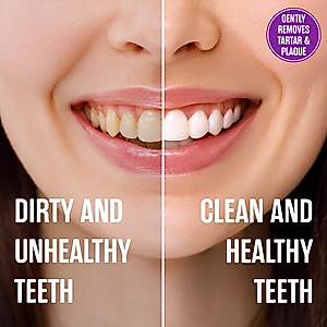 SprinJene Patented Toothpaste Sensitive Teeth & Gum w/Fluoride Cavity Protection Non Toxic SLS Free Fresh Breath Dry Mouth,Preservative Free, 2 Pack