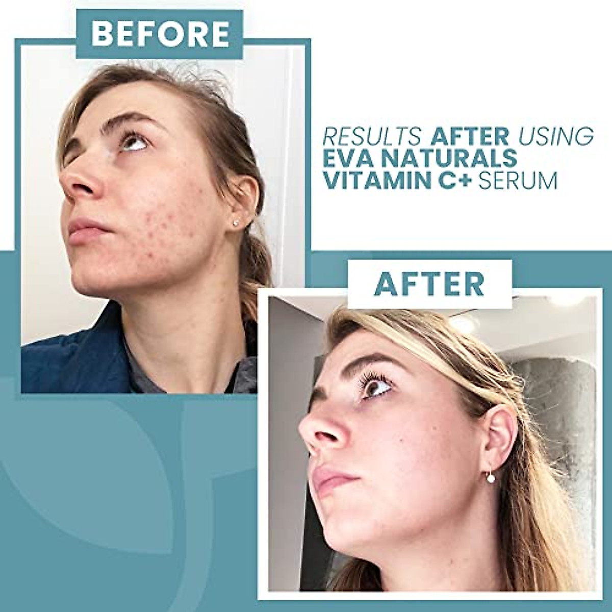 Eva Naturals Vitamin C Serum for Face Plus Hyaluronic Acid, Retinol, Niacinamide & Salicylic Acid, Anti Aging Serum, Reduce Fine Lines, Wrinkles & Dark Spots, Brightening Skin Serum for Glowing Skin (1 oz)