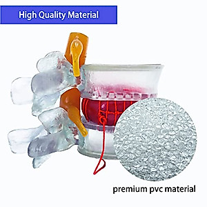 Veipho Human Anatomical Lumbar Disc Herniation Model, Transparency Lumbar Disc Herniation Model, Lumbar Disc Model for Teaching and Demonstrating