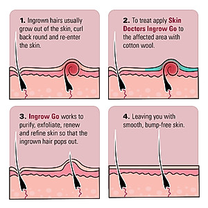 Skin Doctors Ingrow Go Ingrown Hair Lotion 120mls