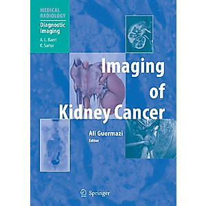 Imaging of Kidney Cancer (Diagnostic Imaging)