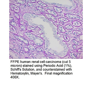 Schiff's Solution, 1000ml