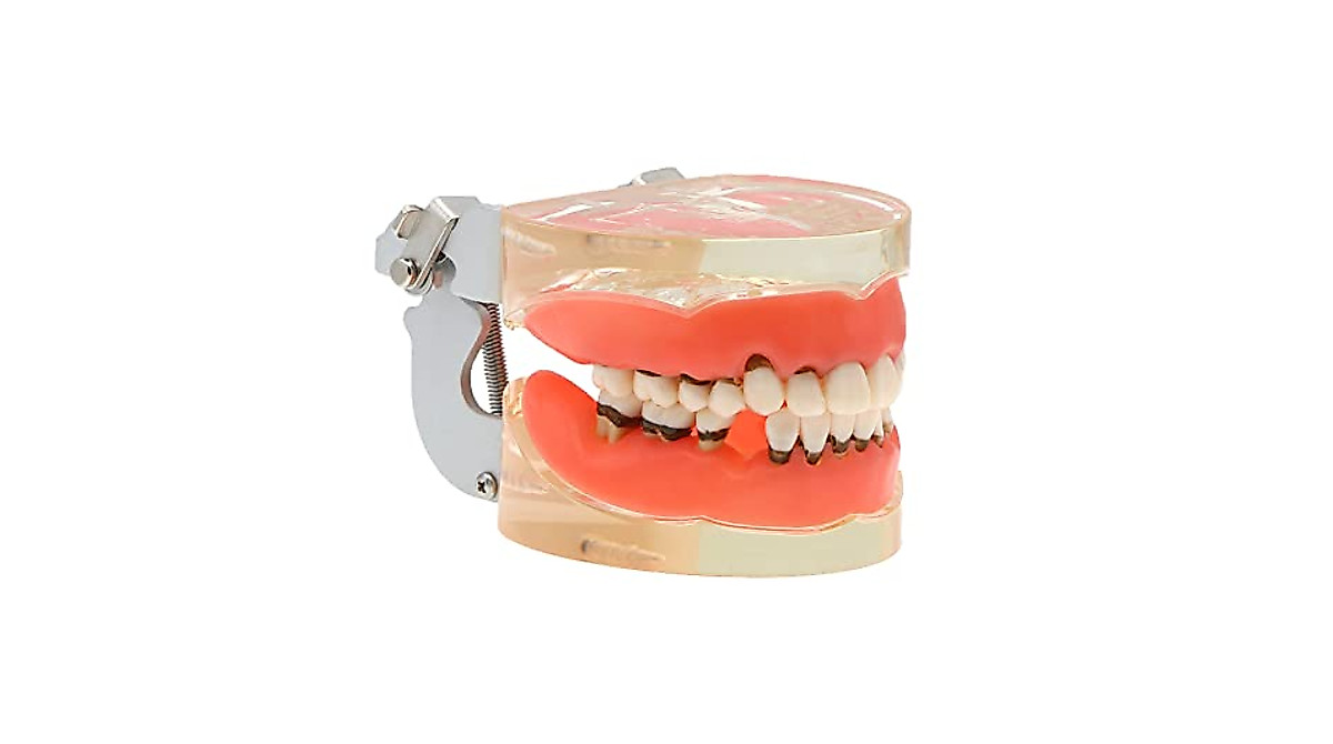 Dental Teeth Typodont Model for Periodontal Disease Education