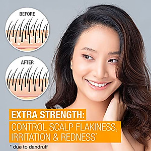 Neutrogena Scalp Therapy Anti-Dandruff Shampoo Extra Strength, with 3% salicylic acid, Fragrance Free, 12 fl oz