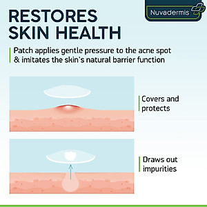 NUVADERMIS Acne Pimple Patches - Dark Spot, Blemish, Zit Treatment - 54% Hydrocolloid Dot Stickers - Hyaluronic Acid, Salicylic Acid, Vitamin A, Tea Tree Oil - FSA HSA Approved Products - 120 Pack