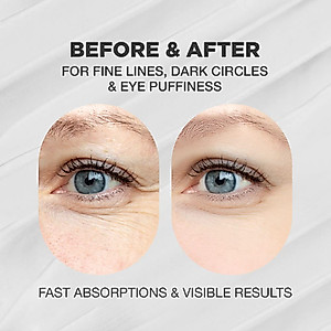 Hibiscus and Honey Eye Firming Cream with Hyaluronic Acid Skin Nourishing Complex | Hibiscus and Honey Firming Cream For Eye Puffiness, Dark Circles and Other Rejuvenating Skincare | Puffy Eyes Skincare for Sensitive and All Skin Type | Skin Reviving Eye