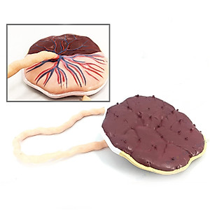 KH66ZKY Human Placenta Umbilical Cord Model - Reproductive System Anatomical Model - Human Internal Organs Medical Educational Training Aid