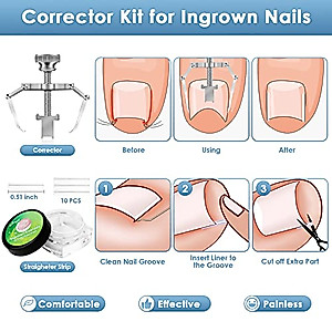 8 PCS Toenail Clippers Kit for Thick or Ingrown Nails, Professional Heavy Duty Ingrown and Thick Toenail Clippers, Sharp Stainless Steel Nail Cutter Set Toenail Pedicure Treatment Tool for Elderly