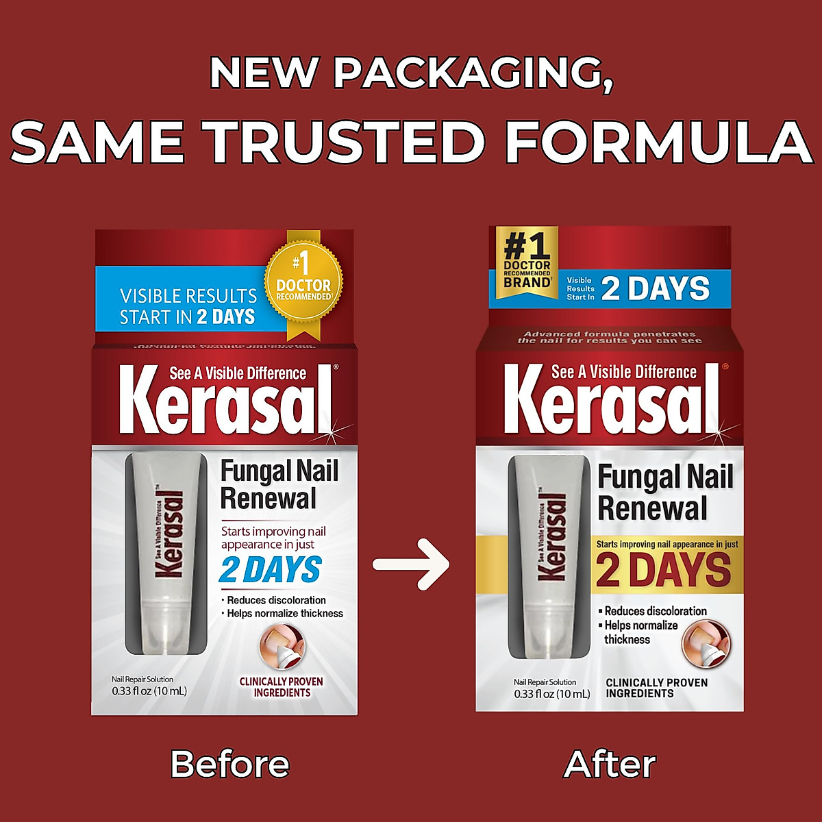 Kerasal Nail Renewal, Restores Appearance of Discolored or Damaged Nails, 0.33 fl oz (Packaging May Vary)