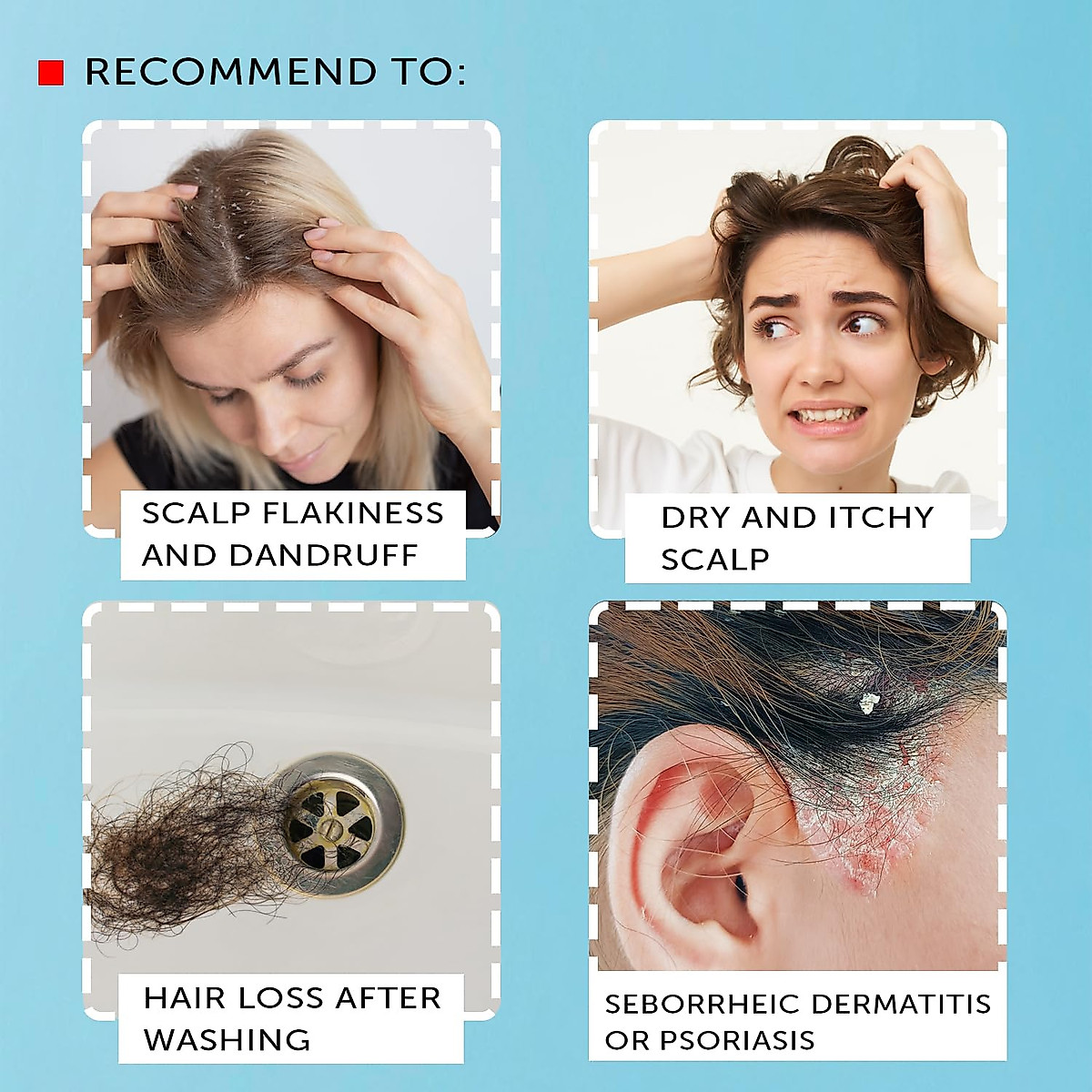 Sent From Earth Caffeine & Saw Palmetto Ketoconazole Biotin dandruff Treatment: Antifungal for Psoriasis, Folliculitis, Dermatitis, Dry Itchy Scalp Vegan Advanced Natural Formula Peppermint Shampoo