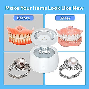 WPDGAD Ultrasonic UV Cleaner for Dentures, 30W Professional Ultrasonic Cleaner Machine for all Dental, Retainer, Aligner, Braces, Mouth Guards, Toothbrush Head, Shaver Head, Jewelry, White