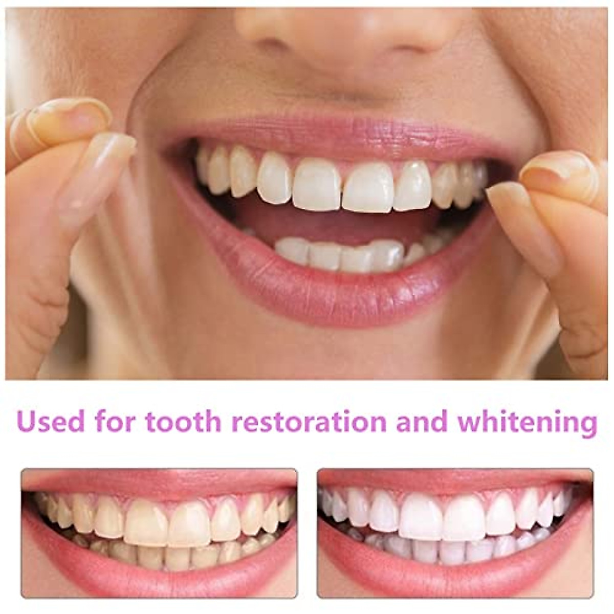 2 Pairs of Instant Veneer Dentures for Men and Women, Customizable Temporary Dentures, Perfect Braces and whitening Replacements, Protect Your Teeth and regain a Confident Smile Multicolor