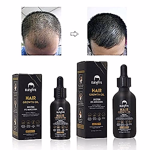 ELEVATE Hair Growth Oil - Biotin Hair Growth Serum & 5% Minoxidil Treatment for Stronger Thicker Longer Hair – Natural Hair Growth Thickening Treatment - Stop Thinning & Hair Loss for Men & Women 1oz