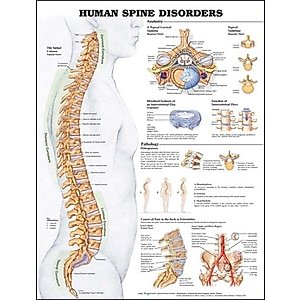 Human Spine Disorders Anatomical Chart
