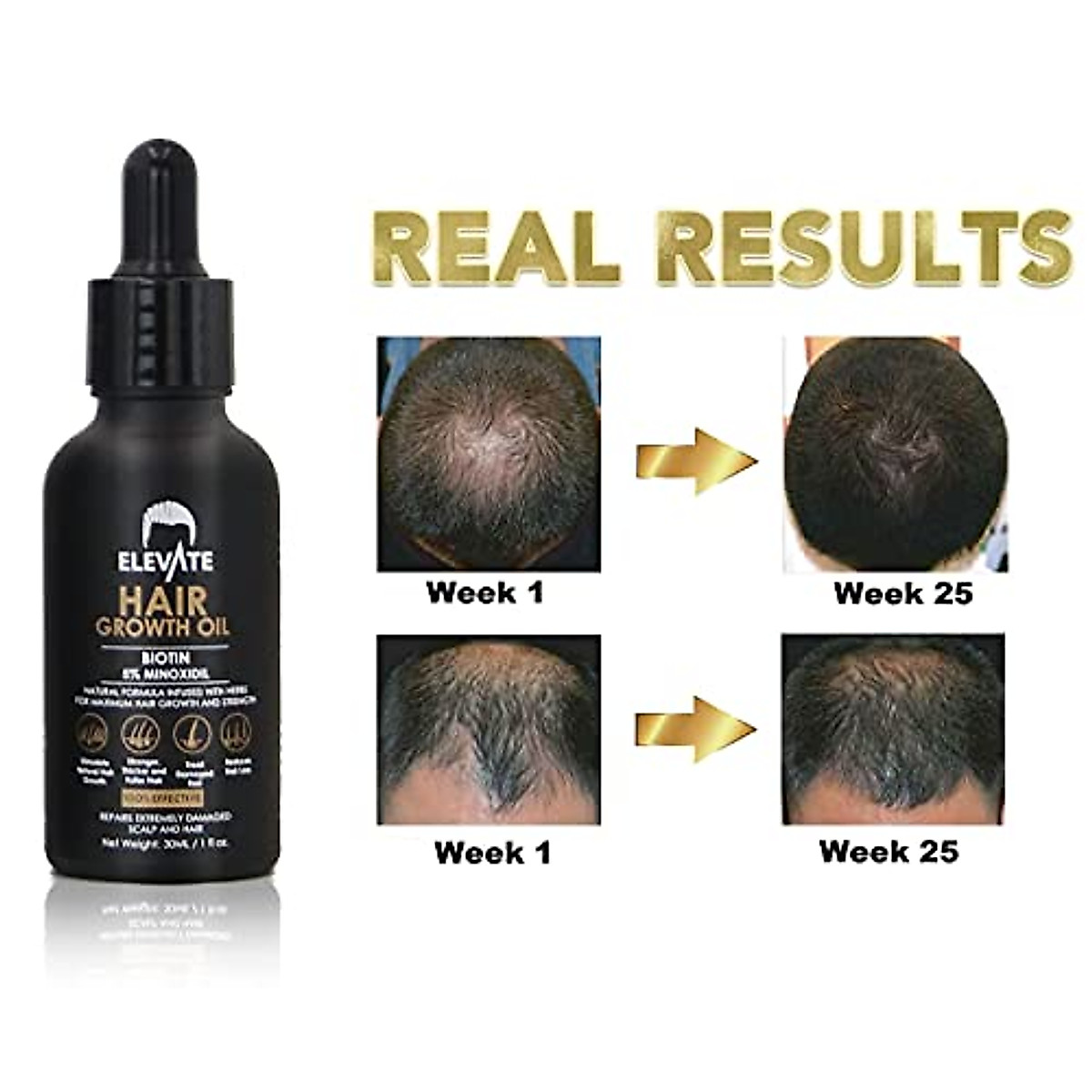 ELEVATE Hair Growth Oil - Biotin Hair Growth Serum & 5% Minoxidil Treatment for Stronger Thicker Longer Hair – Natural Hair Growth Thickening Treatment - Stop Thinning & Hair Loss for Men & Women 1oz