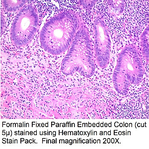 Hematoxylin and Eosin Stain Pack, 1000ml