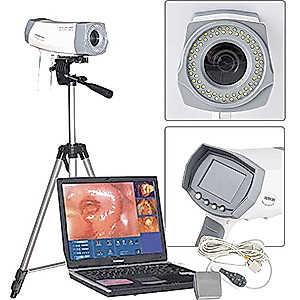 zorvo Digital Electronic Camera Gynecologist Scope Camera,800000 Pixels, Gynecologist Magnifier Camera,with Tripod【US Shipping】