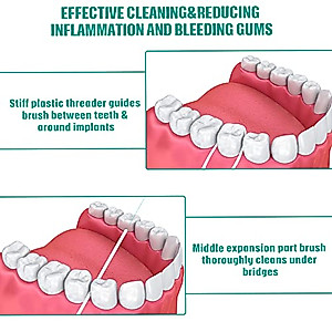 200 Pcs Floss Threaders for Bridges, 4 Packs Dental Floss for Braces, Bridges and Implants, Periodontal Disease Teeth Flossing