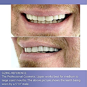 Professional Cosmetic Upper - New from Instant Smile! Hand Crafted Detail, Custom fit at Home! Works Best in Medium to Large Sized Mouths.