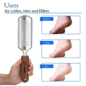Professional Pedicure Foot File, Colossal Stainless Steel Detachable Foot Scrubber, Hard Skin Removers Pedicure Rasp for Wet and Dry Feet