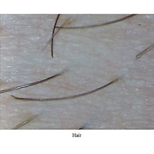 Firefly DE350 Wireless Polarized Handheld Digital Dermatoscope/Microscope