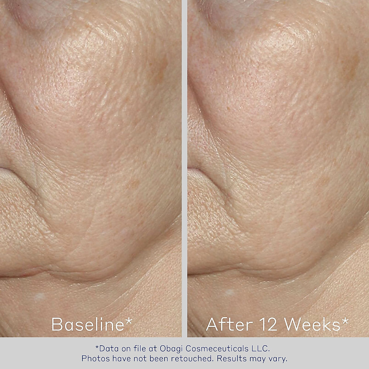 Obagi ELASTIderm Facial Serum – Firming Face Serum with Patented Bi-Mineral Contour Complex Clinically Proven to Target Signs Of Skin Aging – 1 oz