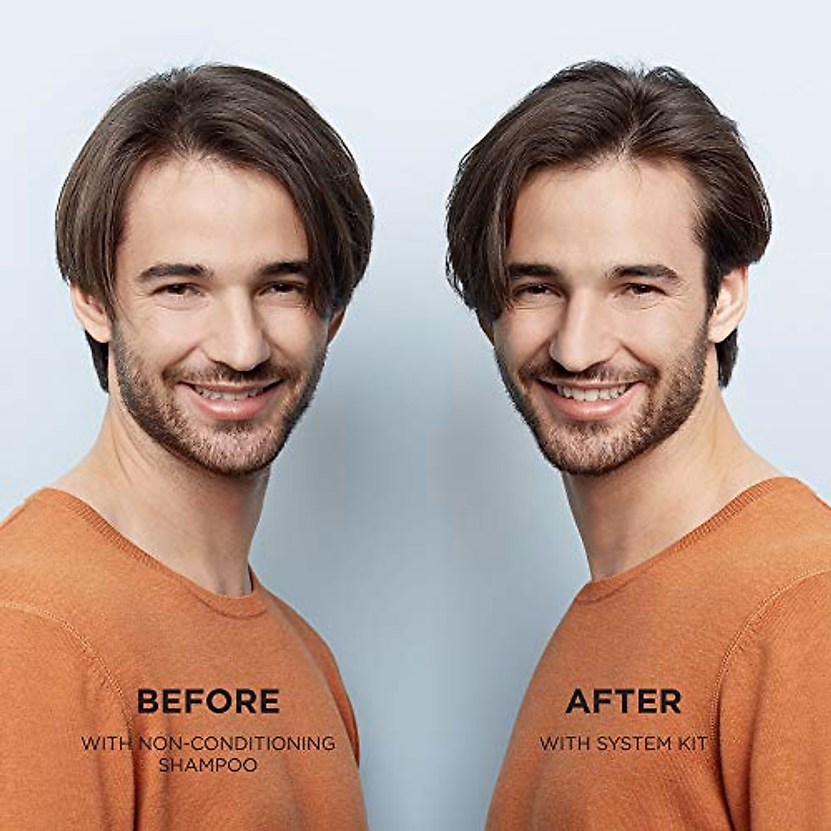 Nioxin System Scalp & Hair Treatment, Natural Hair with Progressed Thinning, 3.38 fl oz