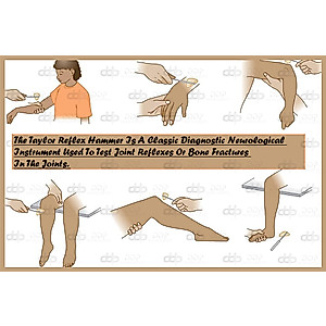 DDP Taylor Hammer Percussion Reflex Rubber Head RED Stainless Steel Instruments