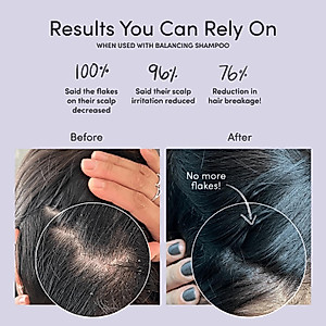 Jupiter Anti-Dandruff Scalp Serum, Leave-On Restoring Serum, for Dry, Itchy, & Oily Scalp, Aloe Vera, & Niacinamide, Color-Safe, Vegan, Cruelty-Free, Paraben, Phthalate, & Sulfate-Free, 3.4 fl oz