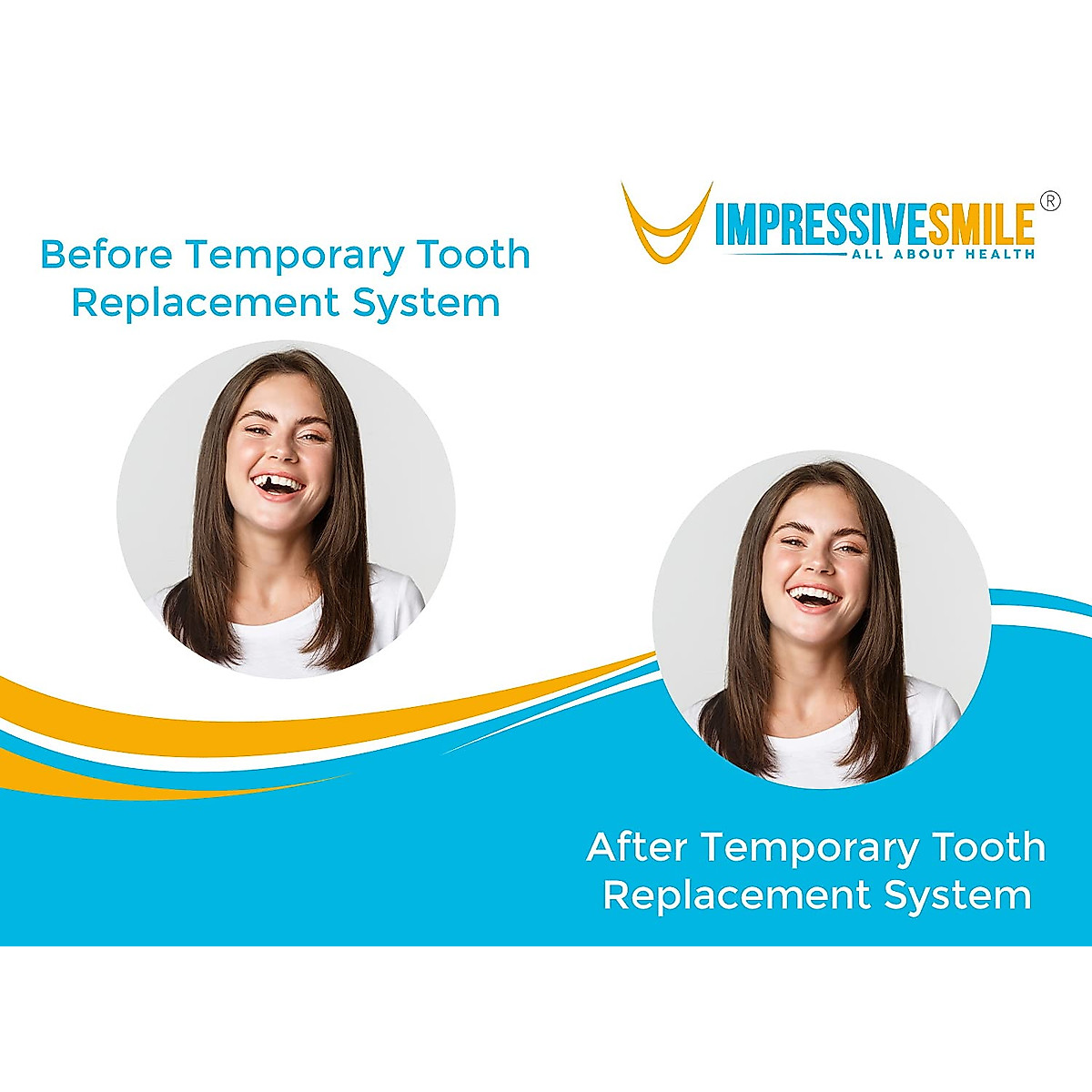 Impressive Smile Patient Trusted Temporary Tooth Replacement System