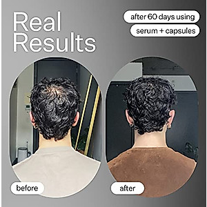 Act+Acre Cold Processed Apple Stem Cell Serum - Promotes Growth and Lessens Hair Loss - Soothes and Hydrates the Scalp - Sulphate and Paraben Free - Aloe Vera for Improved Scalp Health.