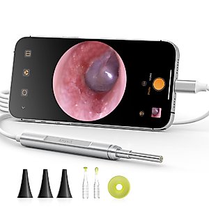 Anykit USB-C Digital Otoscope for Type-C Phone & Tablet, Ultra Clear View Ear Camera with Ear Wax Removal Tools, Video Ear Scope Otoscope with Light, Support Capture Photo & Record Videos