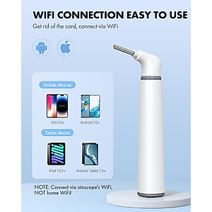 Anykit Wireless Otoscope Ear Camera with Dual View, 3.9mm 720PHD WiFi Ear Scope with Ear Wax Removal Tool for Kids and Adults & Pets, Compatible with Android and iPhone