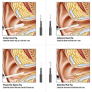 iFCOW Earwax Removal Endoscope, Ear Wax Cleaning Tool with Clear Visual Camera