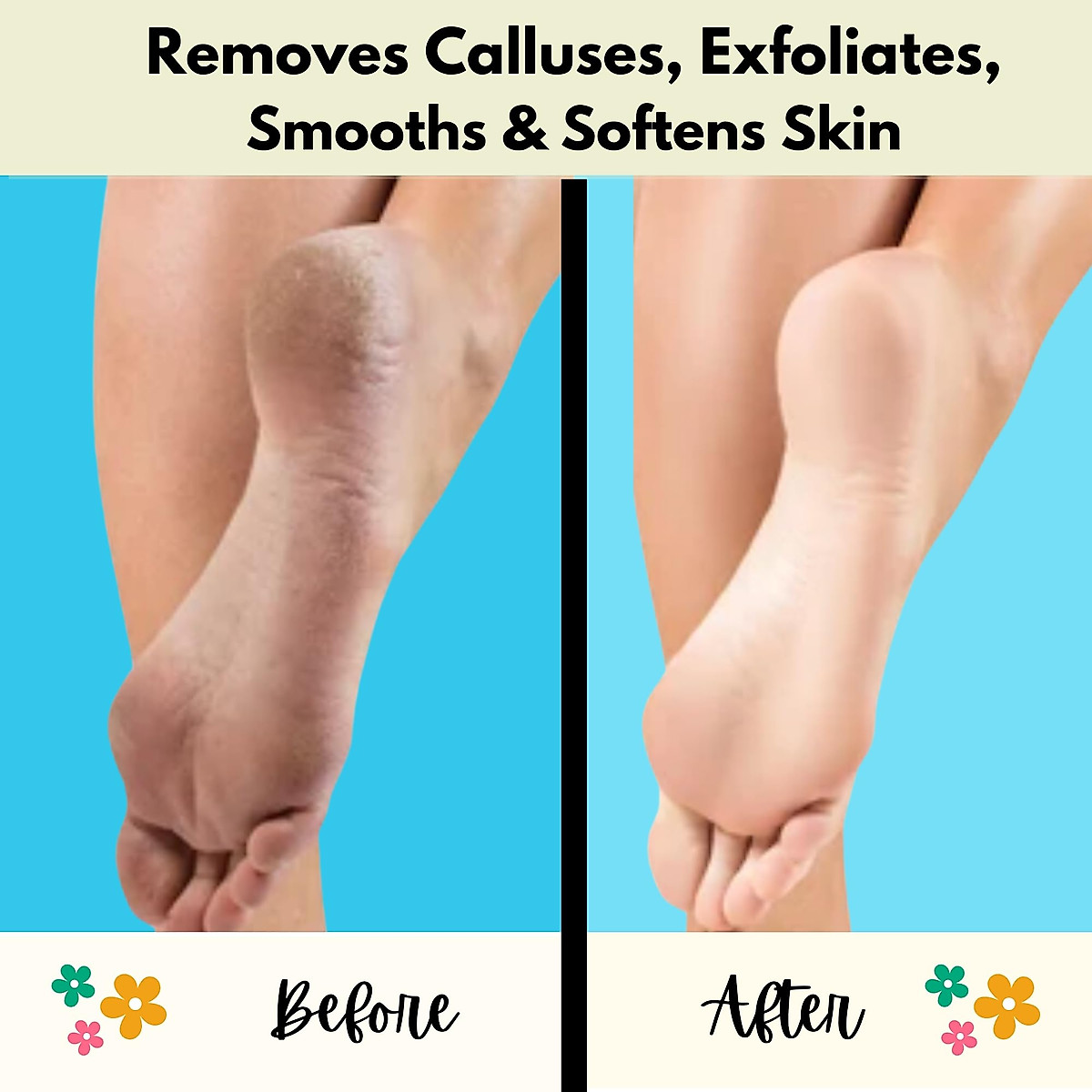 Mr. Pumice Callus Remover PUMI Bar: Pedicure Stone & Foot Scrubber - Medium Grit (Assorted Colors) 24 Pack Display Case