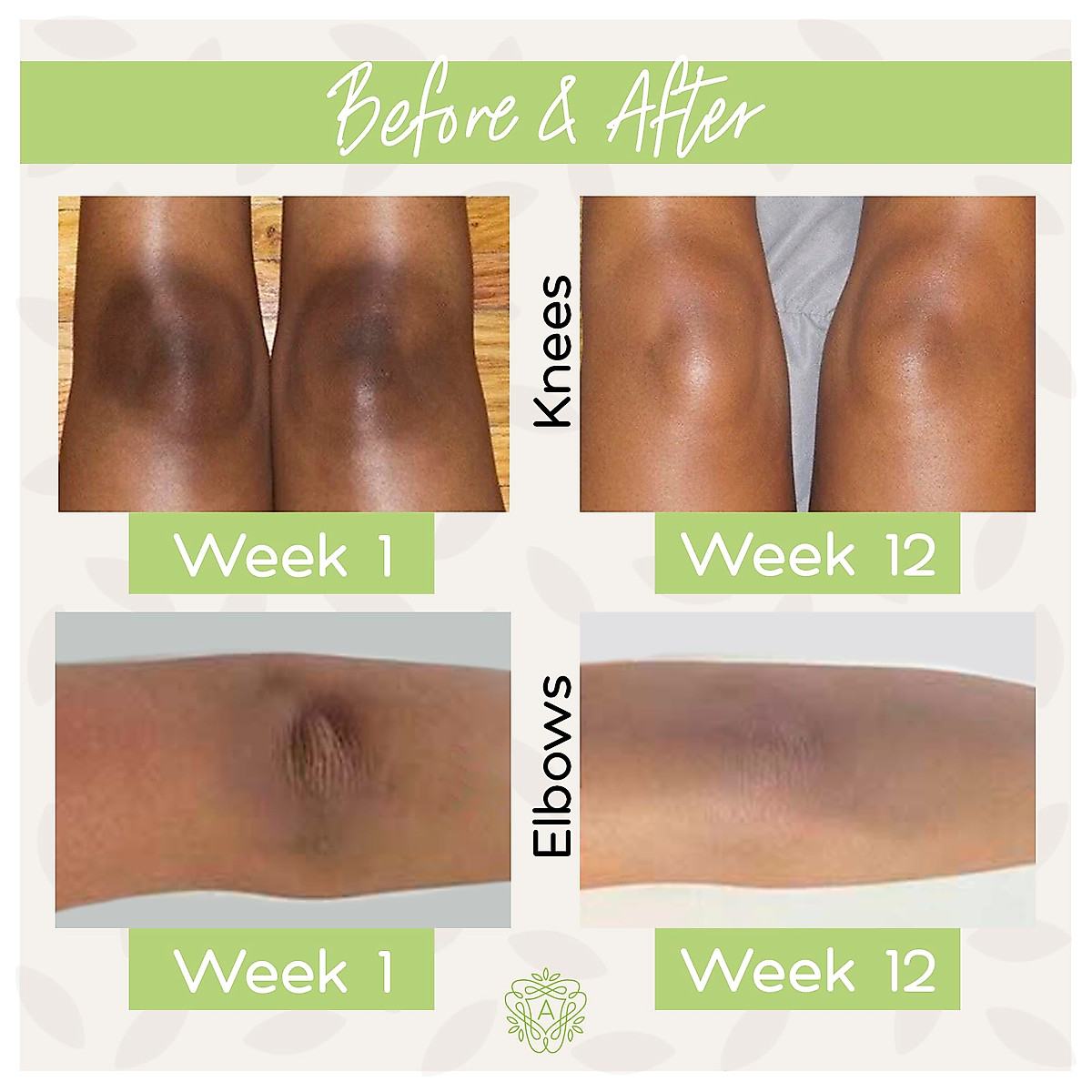 Amaira SOS Intensive Skin Lightening Cream - Natural Brightening Cream and Dark Spot Remover for Body - for Face, Underarms, Knees, Elbows, Dark Spots (1.7 fl oz)